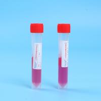 China Sterile Nylon Swab Virus Sampling Transport Tube for Medical Testing - 10ml Capacity, 12 Month Shelf Life for sale
