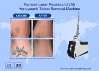 China Nd Yag Picosecond Laser Tattoo Removal Machine Device 755nm 1064nm 532nm for sale
