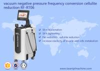 China Vacuum Negative Pressure RF Beauty Equipment Conversion Cellulite Reduction Rf Machine for sale