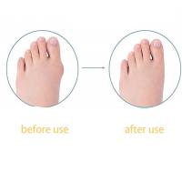 China TPR Adult Big Foot Straightener Bunion Correction Day/Night Children Thumb Toe Straightener For Shoes for sale