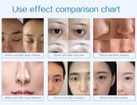 China Professional Spa 14in1 Korean Hydra Dermabrasion Facial Machine Hydro H2o2 Bubble Microdermabrasion Facial Machine for sale