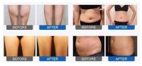 China Detox Body Belly Leg Balancer Pressotherapy Suit Lymphatic Drainage Slimming Body Detox Fat Reduce Warm Machine for sale