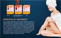 China Best Choice for Permanent Hair Removal 808nm Diode Laser Hair Removal Machine with 12 Laser Bars for sale