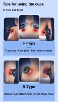 China Trend Vacuum Cupping Therapy Set Class II Body Cupping Cups with OEM ODM Hijama Cups for sale