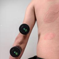 China Fitdash Infrared Cupping Electric Vacuum Cupping Massage Body Cups Cupping Machine Vacuum Therapy for sale