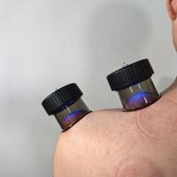 China Massage Equipment Intelligent Vacuum Cupping Massager Set with Type-C Power Mode for sale
