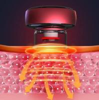 China Bluetooth Electric Vacuum Massager Cupping Therapy for Fitdash Chinese Smart Cupping Cups for sale