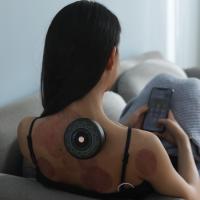 China Button Control Fitdash Smart Cupping Therapy Set for Waist and Anti-Cellulite Cupping for sale