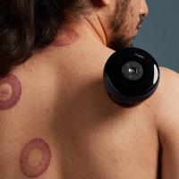 China ABS PC Fitdash Electric Cupping Massager with Vacuum Suction and Electronic Vibration for sale