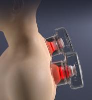 China 94*94*72mm Size Electric Cupping Massager for Whole Body Heating and Fascial Cupping Set for sale