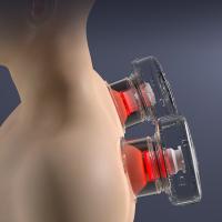 China Fitdash Cuppers Cupping Physiotherapy Tools Cupping Therapy Devices for Improved Health for sale
