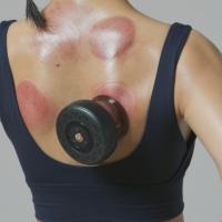 China Fitdash Heat Cupping Therapy 7W Rated Power Electric Vacuum Cupping Massage Equipment for sale