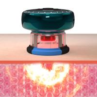 China Fitdash TENS Smart Vacuum Cupper Chargeable and Easy to for Improved Blood Circulation for sale