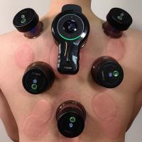 China Fitdash Rechargeable Smart Cupping Cups The Perfect Addition to Your Wellness Routine for sale