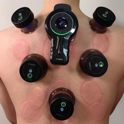 China Fitdash Rechargeable Smart Cupping Cups The Perfect Addition to Your Wellness Routine for sale