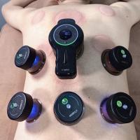 China Intelligent Breathing Cupping with -10kPa--60kPa Suction Strength and 3.7V/150mAh Cup for sale
