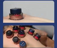 China Intelligent Breathing Cupping with -10kPa--60kPa Suction Strength and 3.7V/150mAh Cup for sale