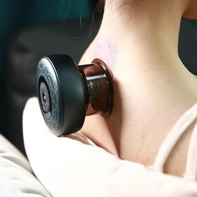 China Revolutionize Your Therapy Sessions with Fitdash Smart Cupping Massager and Type-C Power for sale