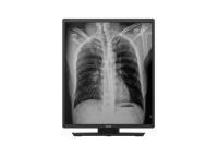 China 110V Veterinary Digital Radiography Equipment Digital Mobile X Ray Machine for sale