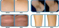 China E Light Salon IPL Hair Removal Machines Vertical For Women for sale