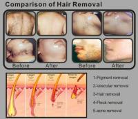China E Light Salon IPL Hair Removal Machines Vertical For Women for sale