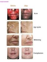 China Professional Oxygen Facial Machine For Skin Care for sale