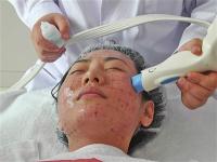 China 10MHZ Radio Frequencies Acne Removal Machine With Non Invasive for sale