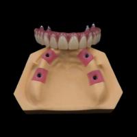 China Dental Implant System Titanium Grade 4 3.5mm Diameter Bone Level Internal Hex Connection for sale