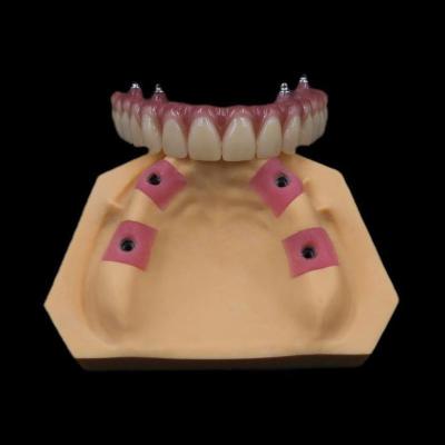 China Dental Implant System Titanium Grade 4 3.5mm Diameter Bone Level Internal Hex Connection for sale