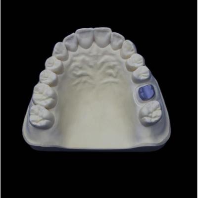 China Dental Post and Core Inlay Core for Tooth Stability Restoration Anchorage Metal 0.75mm to 2.0mm for sale