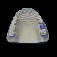 China Dental Post and Core Inlay Core for Tooth Stability Restoration Anchorage Metal 0.75mm to 2.0mm for sale