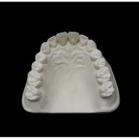 China Translucency E Max Crown Lithium Disilicate Crown High Strength And Biocompatible for sale