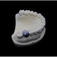 China FCC Richmond Crown Full Cast Crown with Post for Endodontically Treated Teeth Dental Restoration for sale