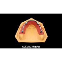 China Custom Milling Abutment for Dental Implants Titanium Zirconia Precision Fit for sale