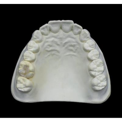 China Composite Inlay Posterior Teeth Restoration Minimally Invasive Dental 2mm for sale