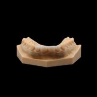 China Porcelain Tooth Veneer 0.3mm Minimally Invasive Stain Resistant for Cosmetic Dentistry for sale