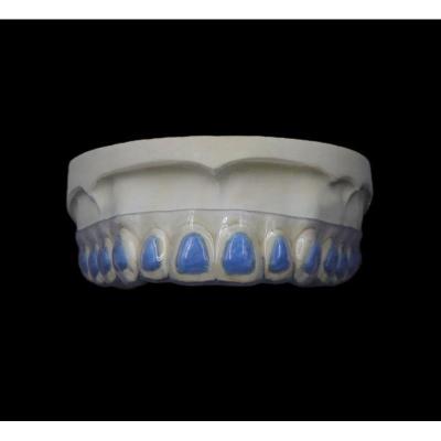 China Custom Fitted Dental Bleaching Tray EVA Material Precise Fit Professional Whitening for sale