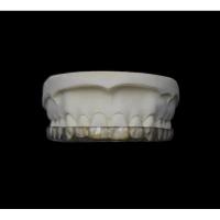 China Custom Medical Grade Acrylic Bruxism Guard 1.5mm 3mm Teeth Whitening Trays Jaw Strain Reduction for sale