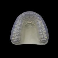 China Custom Medical Grade Acrylic Bruxism Guard 1.5mm 3mm Teeth Whitening Trays Jaw Strain Reduction for sale