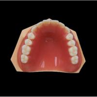 China Biocompatible Acrylic Resin Denture Natural Pink Aesthetics for Partial Complete Tooth Loss for sale