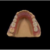 China Hypoallergenic Flexible Valplast Denture Base Fracture Resistant Nylon Polyamide for sale