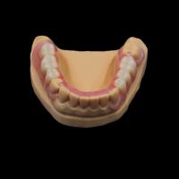 China Hypoallergenic Flexible Valplast Denture Base Fracture Resistant Nylon Polyamide for sale