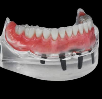 China CCP Transvisse Design Dental Implant Metal Tray Rigid Stainless Steel Impression Tray for sale