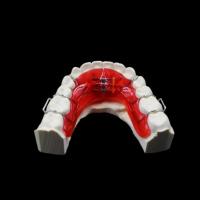 China Orthodontic Palatal Expander for Jaw Alignment 10mm Expansion for sale