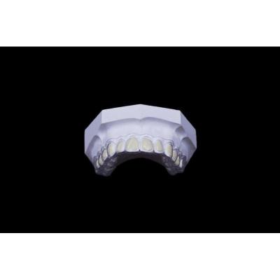 China Custom Fitted Essix Clear Retainer Nearly Invisible Dental Retainer Durable Plastic for sale