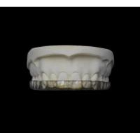 China TMJ Stabilization Splint for Bruxism Relief Acrylic Jaw Alignment 2mm Thickness for sale