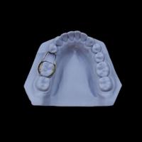 China Orthodontic Space Retainer Removable Dental Appliance 1mm Gap Fix Prevent Teeth Shifting for sale