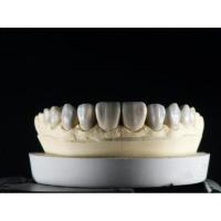 China High Precision Diagnostic Wax Up Dental Lab Wax for Custom Restoration Planning for sale