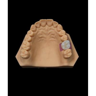 China PFM Dental Implant Cement Chrome Cobalt for Edentulous Restoration 30g for sale