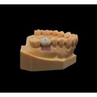 China Chrome Cobalt PFM Implant Screw Reusable Abutment 4.0mm Diameter Dental for sale